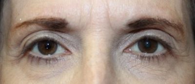 Leon Rafailov, MD - SightMD