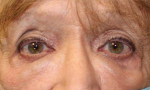 Leon Rafailov, MD - SightMD