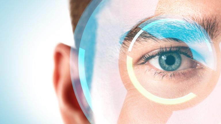 How Long Does LASIK Recovery Take? - SightMD
