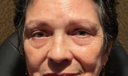 Omar Almallah, MD - SightMD