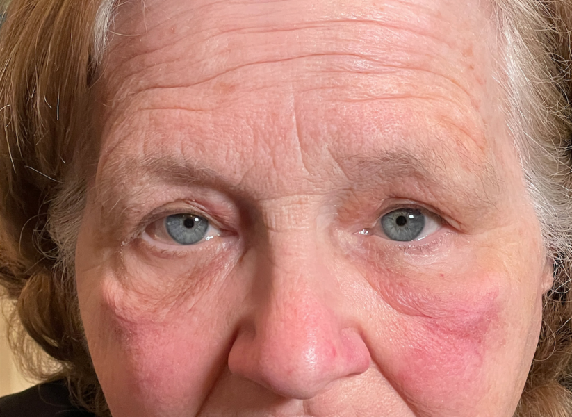 Omar Almallah, MD - SightMD