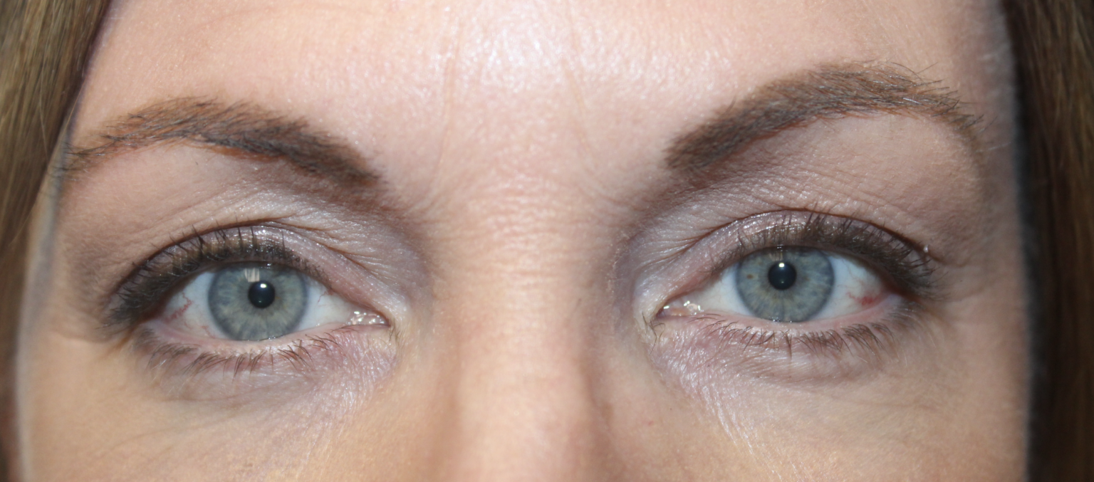 Samuel Baharestani, MD - SightMD