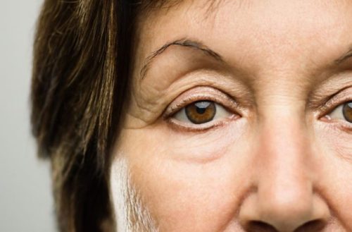 What Causes Your Eyelids to Start to Droop? - SightMD