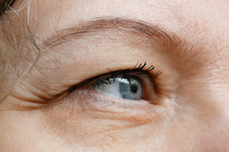 What Is The Most Common Cause of Ptosis? - SightMD