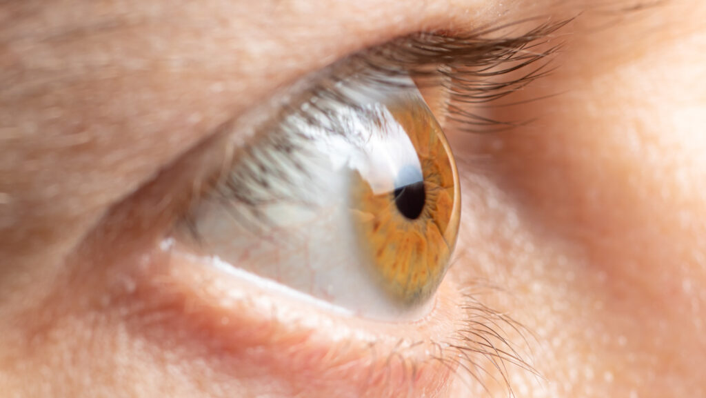 Understanding Thyroid Eye Disease - SightMD