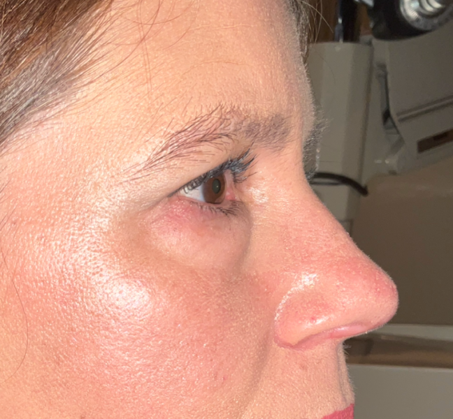 Sana Ali, MD - SightMD