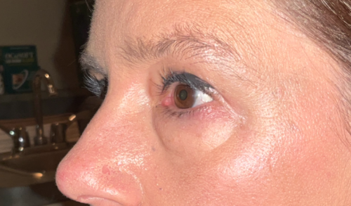 Sana Ali, MD - SightMD