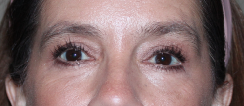 Sana Ali, MD - SightMD